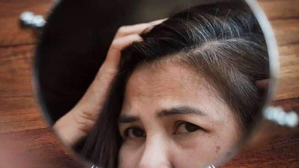 White Hair Problem: ઢળતી ઉંમરે પણ દેખાવ જવાન, આ ઘરેલું નુસ્ખા દૂર કરશે ...
