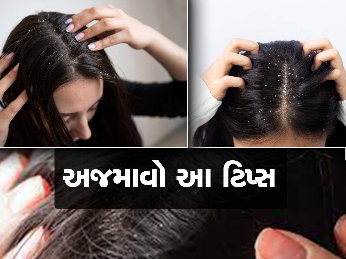 Dandruff Home Remedies Follow these Ayurvedic treatment to get rid of dandruff hair fall solution