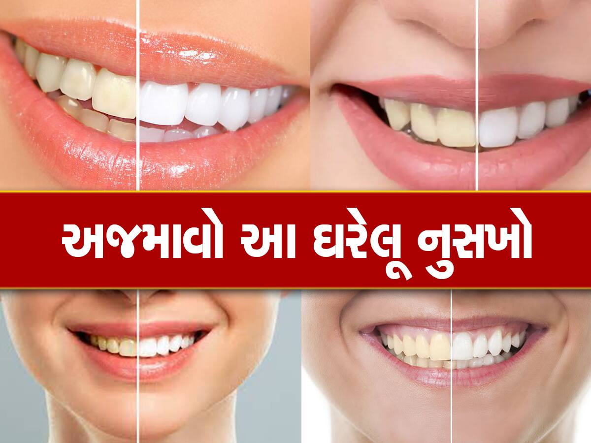 પીળા દાંત સફેદ મોતી જેવા ચમકાવવા છે તો 5 રૂપિયા કરી લો ખર્ચ, હસતા નહી ...