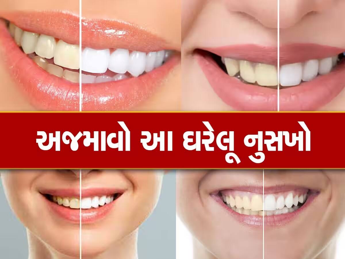 Teeth Whitening: દાંતની પીળાશ, કેવિટી અને દુર્ગંધથી પરેશાન છો? એકવાર ...