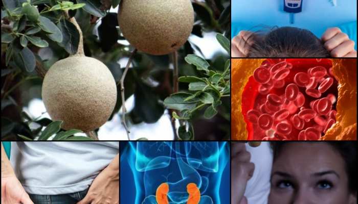 Wood Apple Benefits: 5-10 રૂપિયાનું જાદૂઇ ફળ કરશે 5 બિમારીઓનો નાશ, એકદમ ...