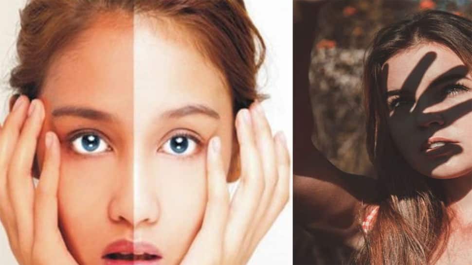 home remedies to get rid of sun tanned skin get instant benefits