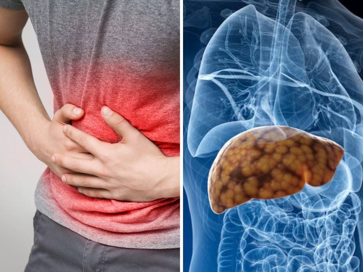 Early Sign Of Liver Disease | First stage of liver disease | સતત પેટમાં ...