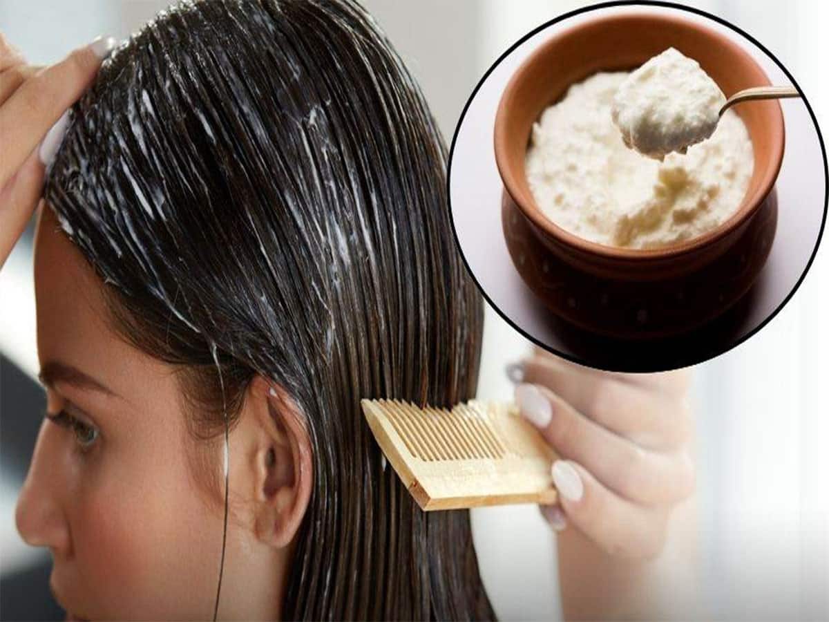 Curd Hair Masks For Dandruff | how to use curd for dandruff | ખોડો દુર ...