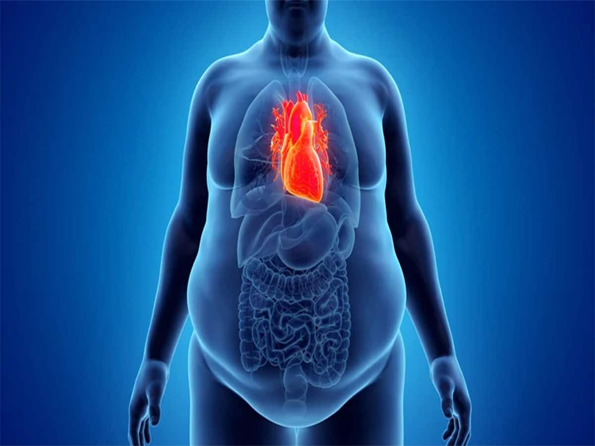 Health Problems Caused by Obesity | organ damage caused by obesity ...