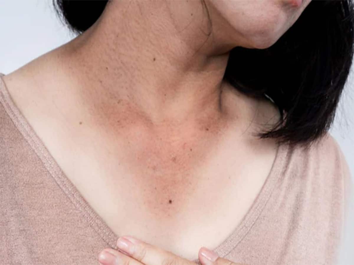 Dark Neck Home Remedies | home remedies for Neck tanning | ગરદનની કાળી ...