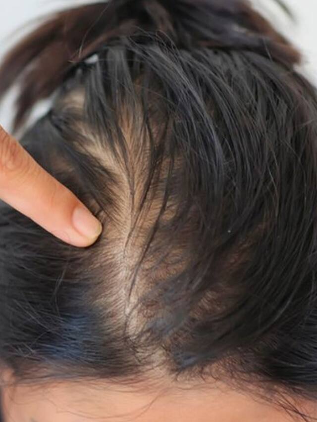 take care hair with these tips to get rid of excessive hair fall in ...