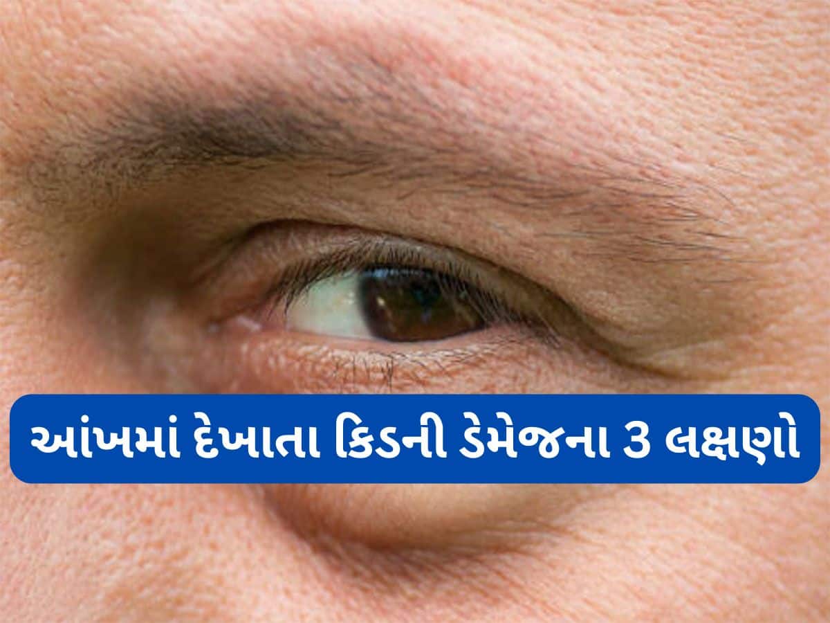 Kidney Damage Signs in Eyes | kidney disease eye symptoms | આંખમાં ...