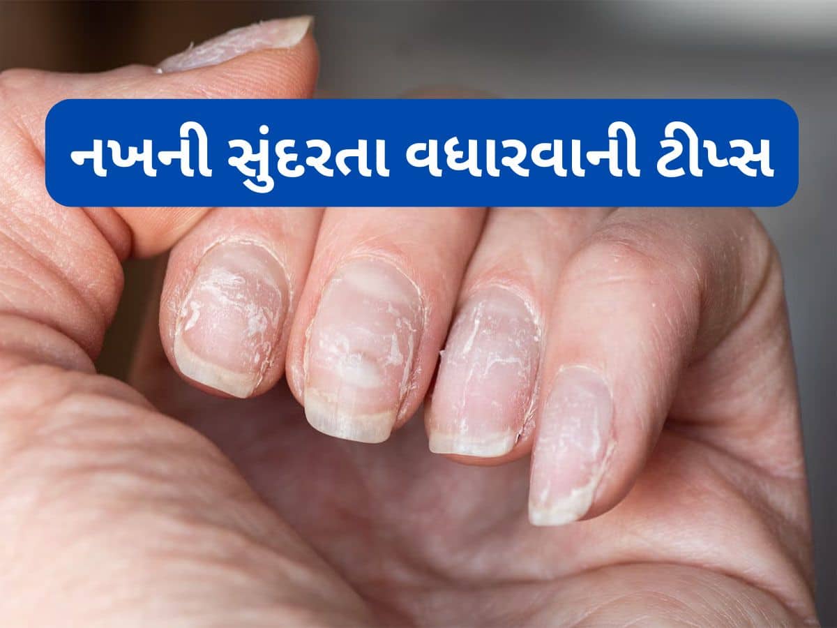 Brittle Nail Care Tips | yellow nails ko white kaise kare | how to make ...