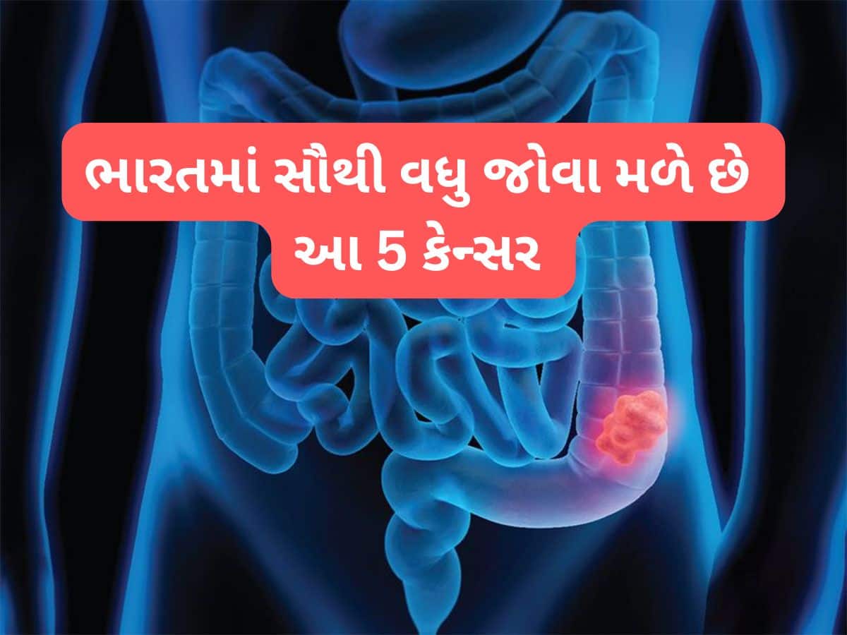 World Cancer Day 2026 | most common cancers in India | કયા કેન્સરના કેસ ...
