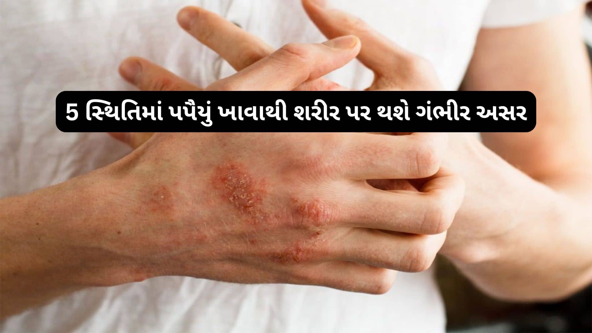 Papaya Side effects on skin | પપૈયું કોણે ન ખાવું | papaya khane se ...