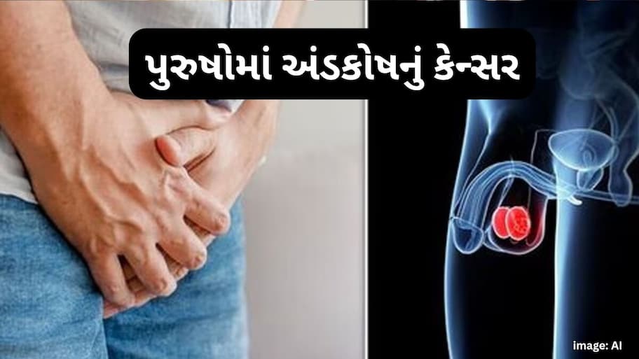 What are 5 signs of testicular cancer | શું હોય છે ટેસ્ટિકુલર કેન્સરના ...