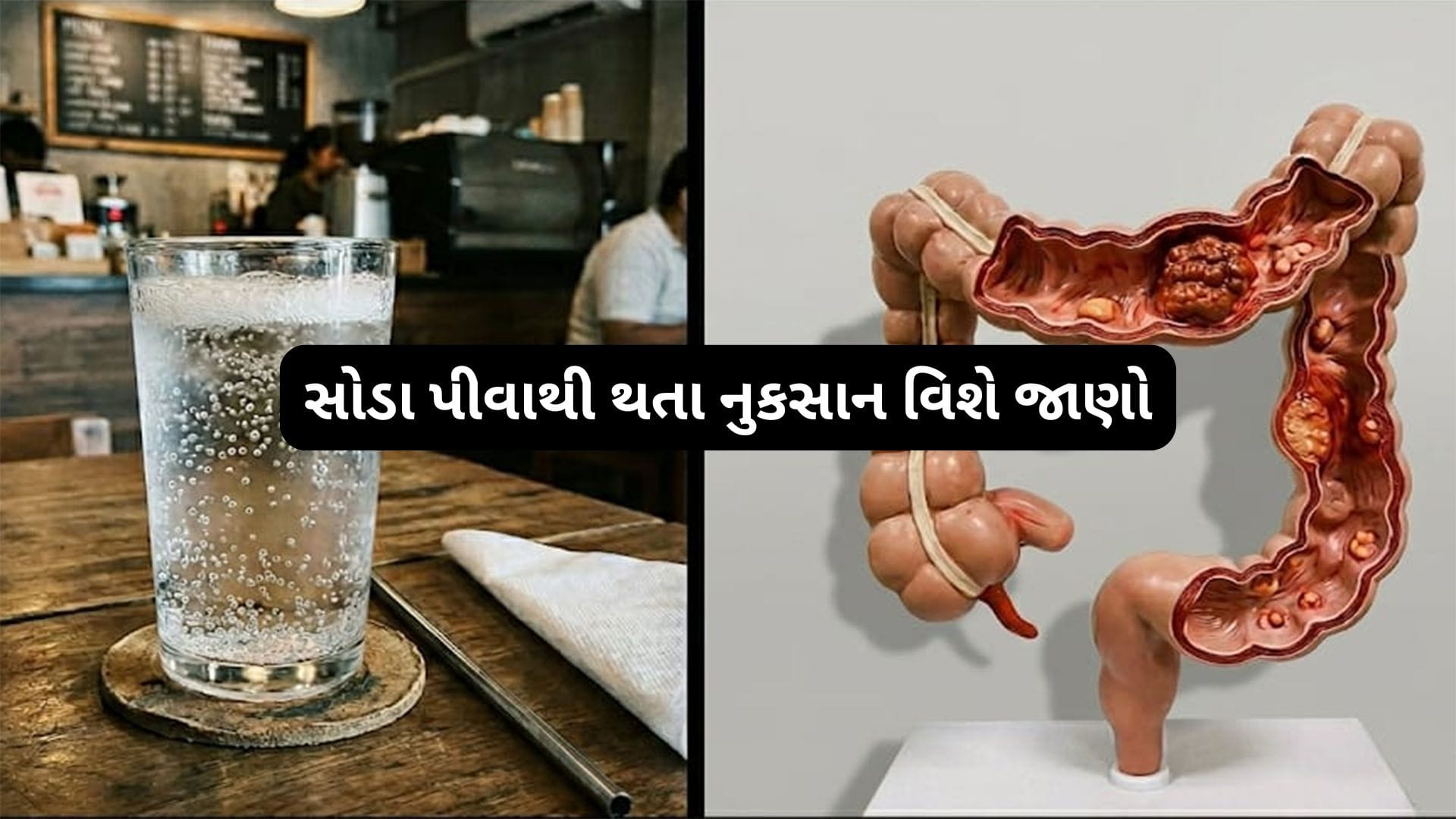 Colon Cancer: સોડા પીવાથી ગેસ, કબજિયાત મટતાં નથી! રોજ સોડા પીવાથી વધી ...